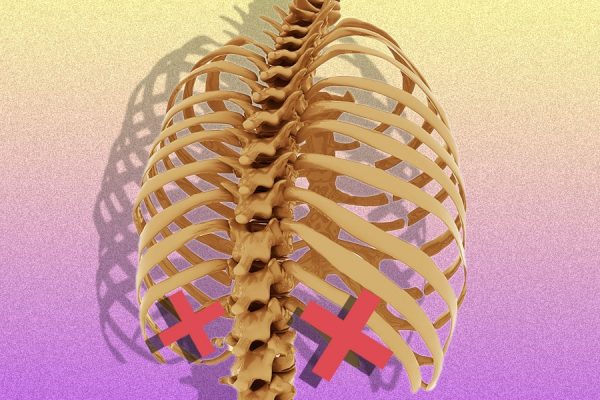 Rib Removal Surgery - Cost, Importance and Risks - Sutured