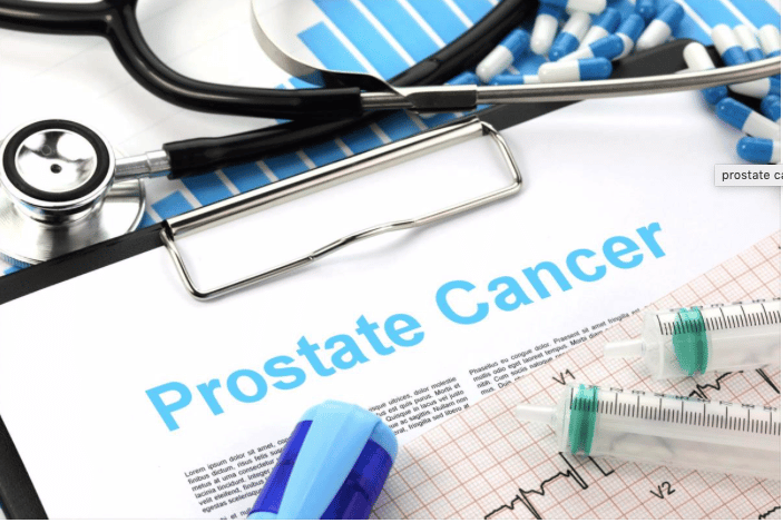 Prostate Cancer Surgery | Types and Procedure - Sutured