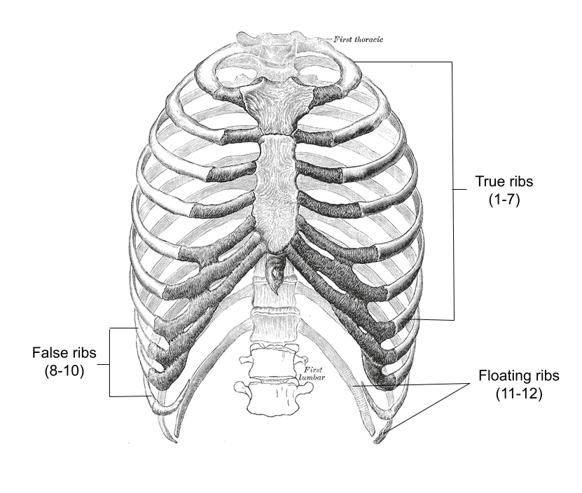 floating-rib-syndrome-sutured