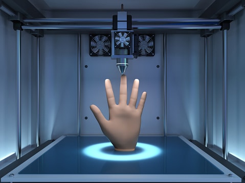 Hand Transplant | Technique | Cost | Outcomes - Sutured